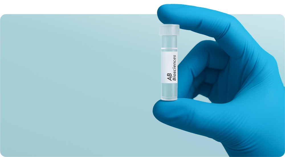 AB Biosciences